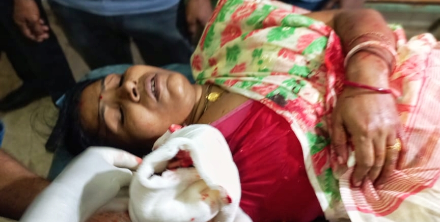 Lorry Brushed Bus; Woman Lost Arm